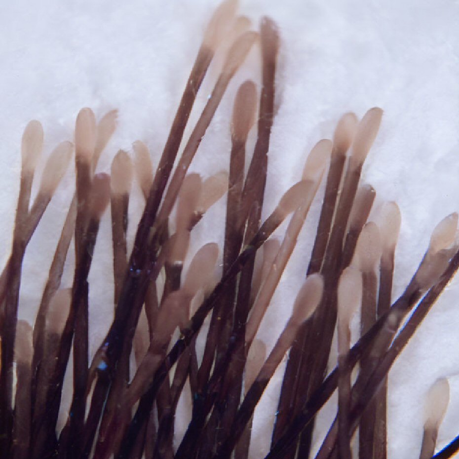 The hair mount test: an indispensable tool in dermatology - keratin.com